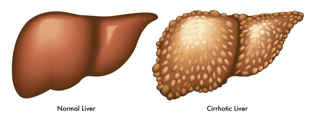 december, 2019 | Blog : Sport en voedings supplementen advies door ...